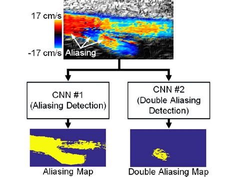 Use Of Two Cnns For Aliasing Detection In Ultrasound Cfi Cnn 1 Is For