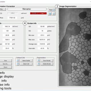 GUI Of The Segmentation Corrector Software Developed For This Research Download Scientific