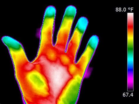 Stress, Anxiety, Biofeedback, Relaxation Skills: Why are patients hands ...