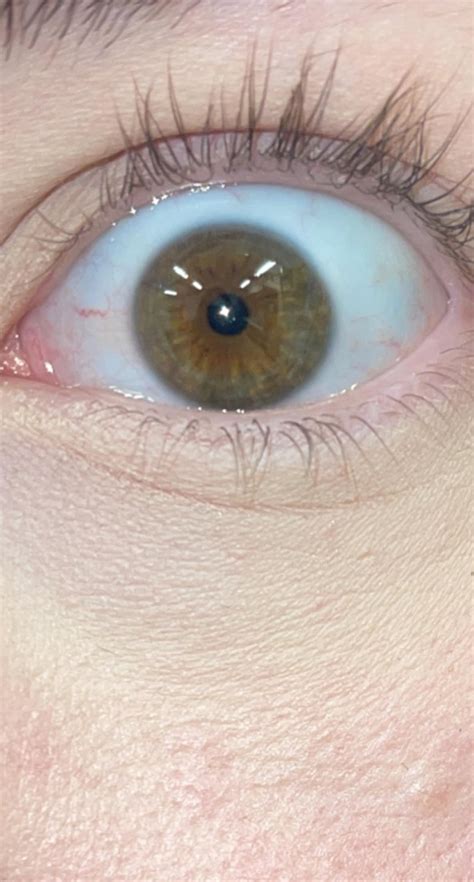 Are My Eyes Still Just Brown Even Though Theres Blue Rings Reyes