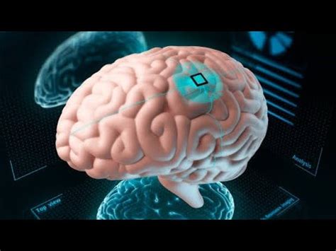 Remote Neural Monitoring Youtube