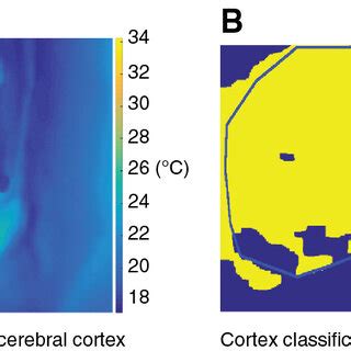 This Validation Dataset Was Subject To The PCA CRF Classifier And The Download Scientific