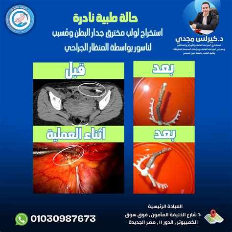 عيادة د كيرلس مجدي للجراحة العامة و المناظير Dr Kerollos Magdy Clinic