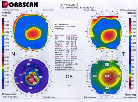 TopografÍa Corneal Manual De Uso Y Disfrute 3 OptoclÍnicos