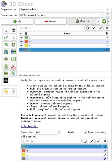 How To Merge Multiple Segments At Once Support D Slicer Community