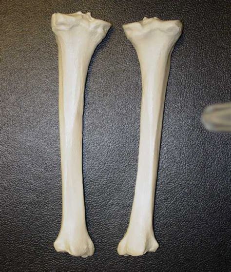 Tibia Posterior View Diagram Quizlet