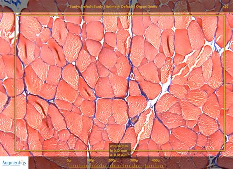 Digital Pathology Image Analysis Software Augmentiqs