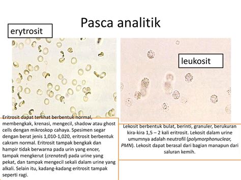 Detail Gambar Eritrosit Pada Urine Koleksi Nomer 8