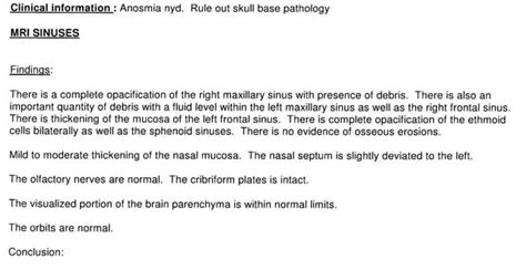 Sinus Mri Findings R Sinusitis