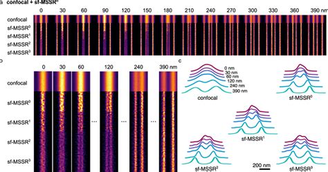 Sf MSSRⁿ extends spatial resolution in confocal microscopy a Comparison Download Scientific