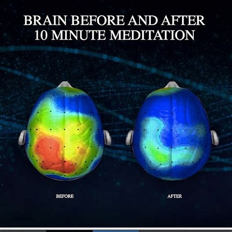 An Image Of The Brain Before And After Meditation I Like Flickr