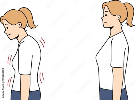 Stooped Woman Before And After Correcting Posture Thanks To Massage