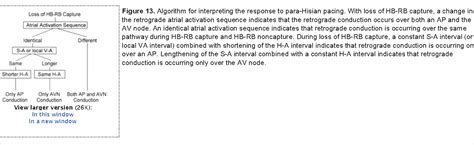 Structure Of Atrioventricular Node Semantic Scholar