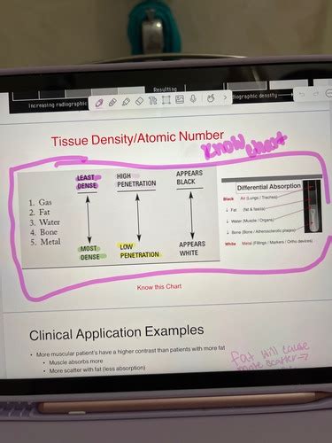 Exposure Contrast Flashcards Quizlet