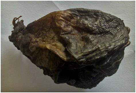 Youth Arrested With Bear Gallbladder From Kageswori Manahara The