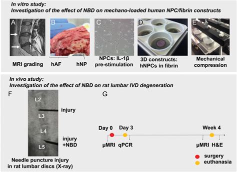 Nf κb Inhibitor Nemo Binding Domain Peptide Attenuates Intervertebral