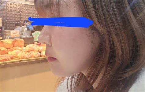 자유수다 코를 어떤 느낌으로 강남언니 1등 성형수술and피부시술 정보앱