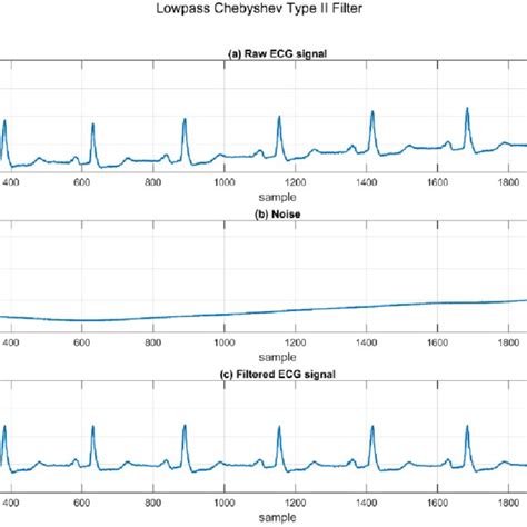 Elimination Of Ecg Signal Noise With Chebyshev Type Ii Filter 105th