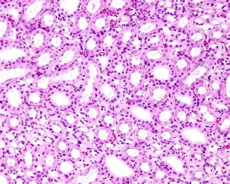 Renal Medulla Light Micrograph Stock Image C049 9121 Science