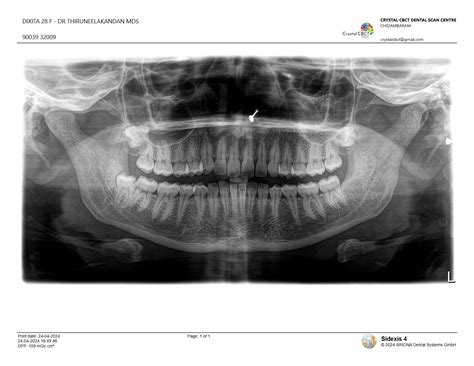Sex Estimation Keypoint Detection Dataset By Dental Radiology