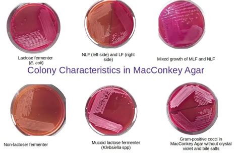 Enterobacter Aerogenes Macconkey Agar