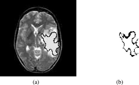 Figure 2 From Cramer Rao Bounds For Parametric Shape Estimation In