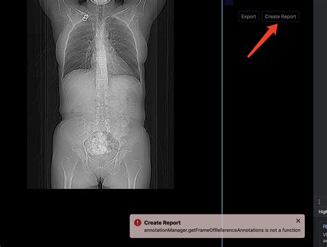 Can Not Create A Report · Issue 3239 · Ohifviewers · Github