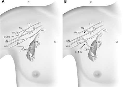 Intercostobrachial Nerve The Altering In Sensory Sensitivity A