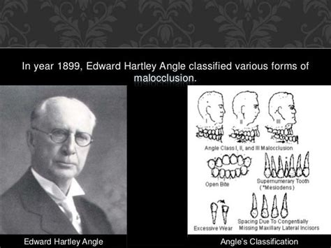 Edward Angle Alchetron The Free Social Encyclopedia