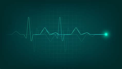 Using Ai To Improve Ecg Data Capture On Portable Devices