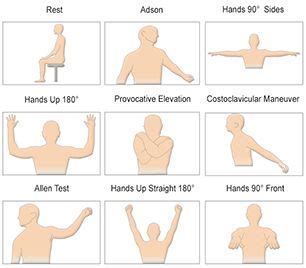 40 Best Upper Extremity Dysfunctions And Assessments Images On