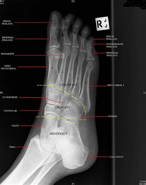 Foot X Ray Labelled Normal Radiographic Anatomy Of The Foot Iloc