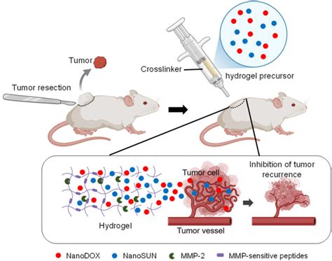 Application Of Mmp 2 Responsive In Situ Forming Injectable Hydrogel In Preventing The Recurrence