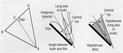unit 4 bisecting angle technique flashcards quizlet