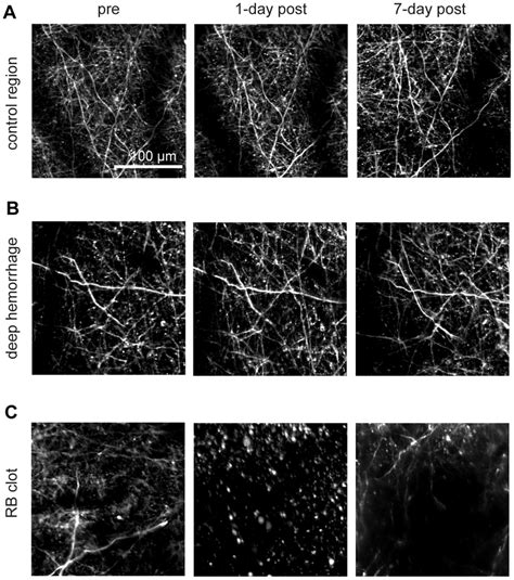 Acute And Chronic Imaging Of Dendrite Morphology For Controls And After