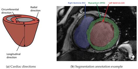 Bioengineering Free Full Text Myocardial Segmentation Of Tagged Magnetic Resonance Images