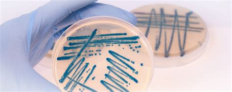 Chromogenic Media Synbiosis