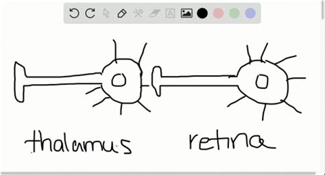 SOLVED If Axons From The Retina Were Prevented From Showing Spontaneous Activity During Early