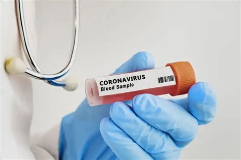 Le Test Antigénique Vitros® Sars Cov 2 Dortho Clinical Diagnostics à