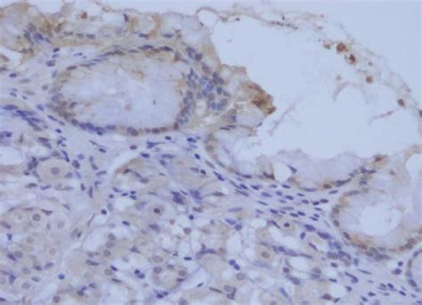Representative IHC Staining For TLR In Gastric Cardia Mucosae With Download Scientific Diagram