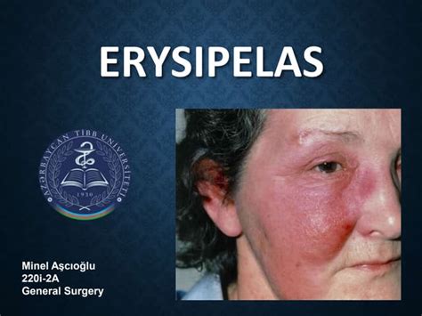 Erysipelaspptx