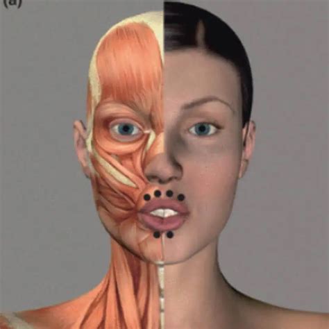 Botox Where To And How Much Meamo