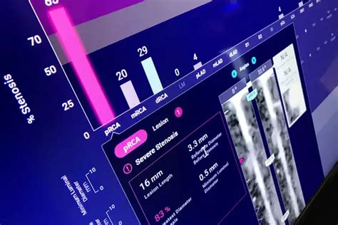 AI Based Software Development MyCTO CTO As A Service
