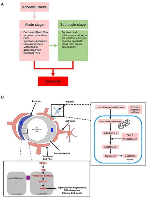 Ischemic Stroke Treatment Options