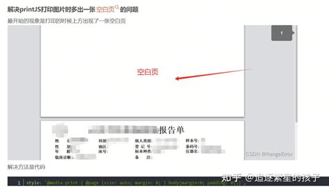 Vue3 用printjs 打印每次会多一张空白纸出来 怎么处理 知乎