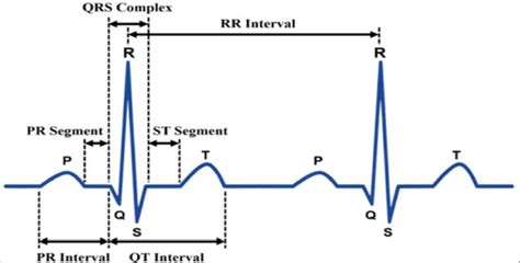 Normal Ecg Signal [12] Download Scientific Diagram