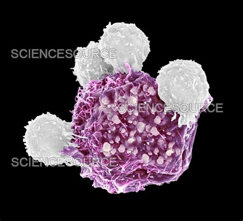 T Lymphocytes And Cancer Cell Sem Stock Image Science Source Images