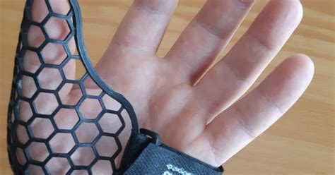 Thumb Splint By Pflotschhoger Download Free Stl Model Thumb Splint By Pflotschhoger Download Free Stl Model