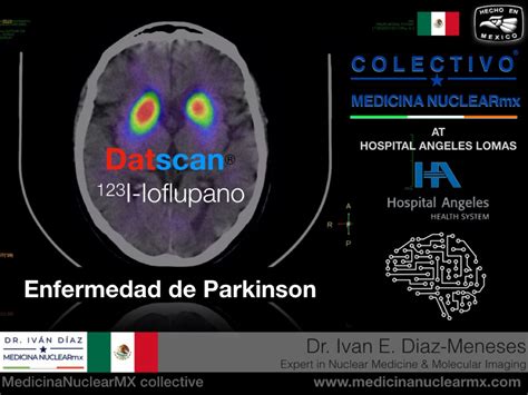 Molecularimaging Parkinson Nuclearmedicine Ivan E Diaz Meneses