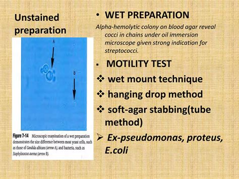 Identification Of Bacteria Pptx Infectious Diseases Diseases And Conditions